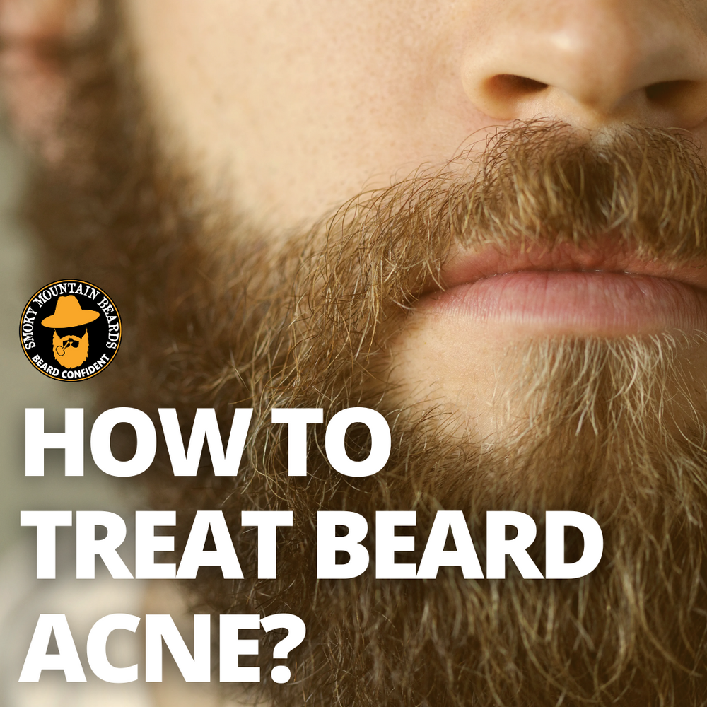 How to Kick Beard Acne to The Curb | Smoky Mountain Beard Co.